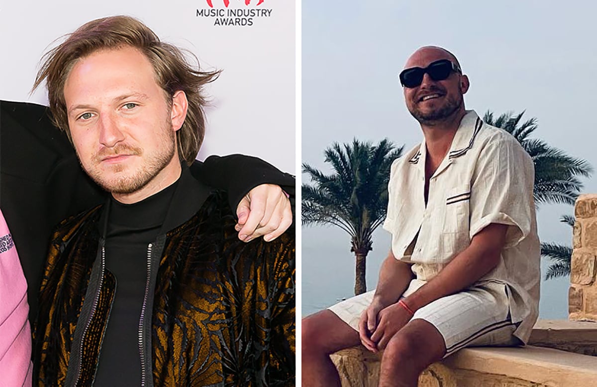 Mannen over hun wijkende haarlijn: ‘Op chirokamp, met alcohol in het ...