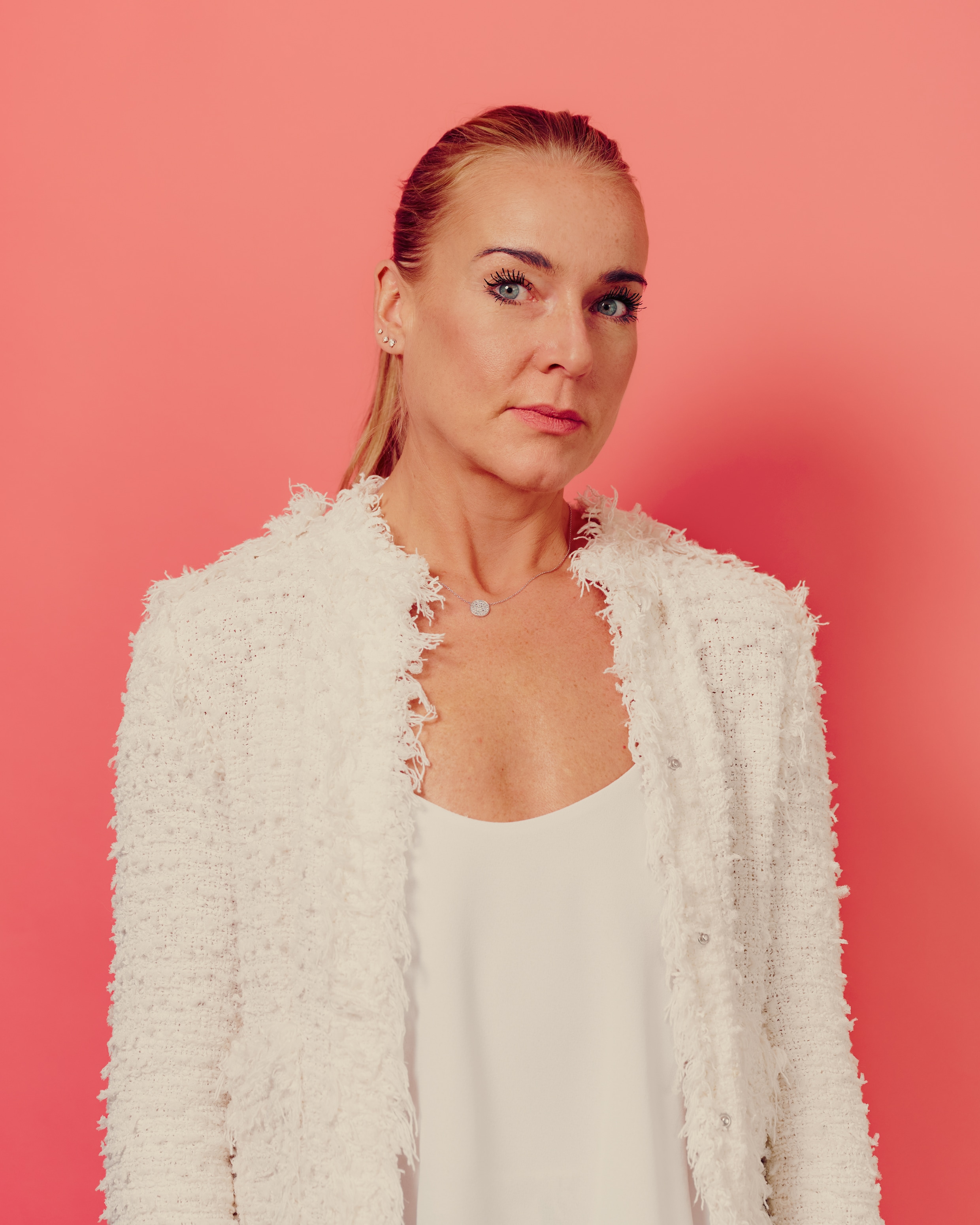 Wat als je spijt krijgt van botox, fillers en neuscorrecties? ‘Ik dacht ...