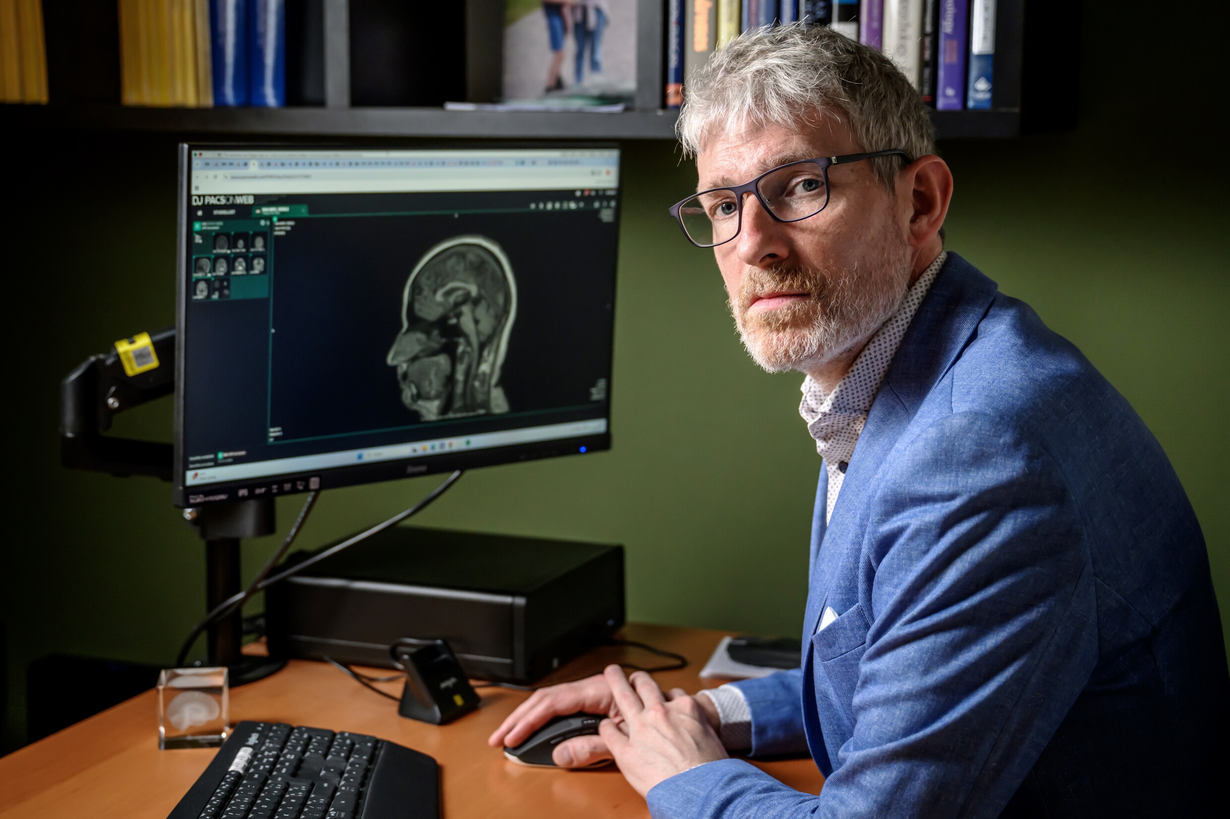De gekste verhalen bij de neuroloog: ‘Slaapstoornissen kunnen extreme ...